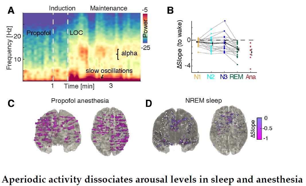 How can I run sleep and anesthesia studies with intracranial EEG? | Helfrich Lab